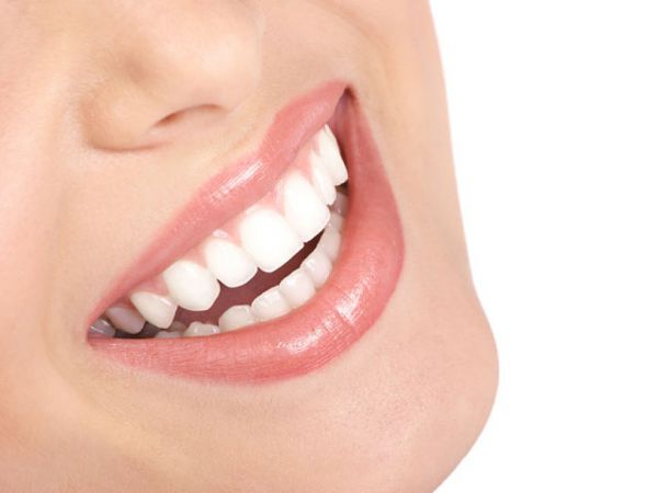 Boca Sana, Bonita y Radiante el día de tu boda